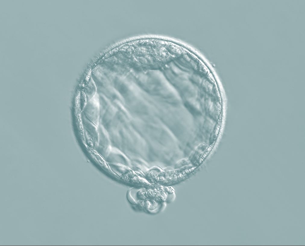 Sobrevida embrionaria – Guía de Reproducción Asistida