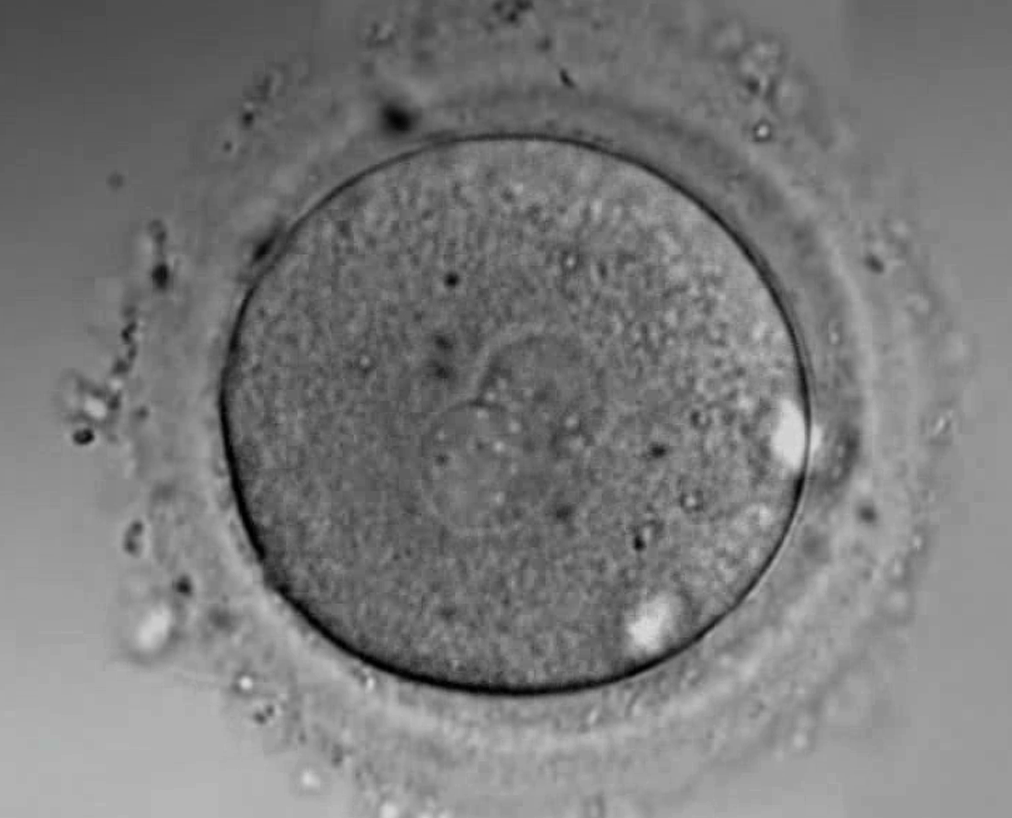 Tipos de Fecundación: FIV e ICSI – Guía de Reproducción Asistida